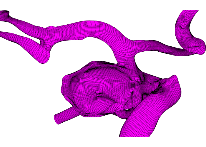 Know Your Mesh for CFD in Biomedical Applications – GridPro Blog